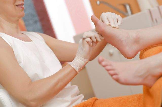 Avea calusuri la picioare și a scăpat de operație cu două lucruri pe ...