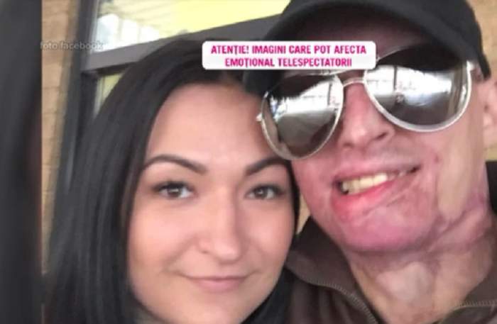 VIDEO / Mutilat cu acid sulfuric, Daniel Rotariu şi-a refăcut viaţa ...