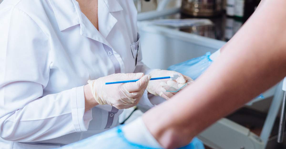 Ce înseamnă frotiu inflamator la testul Papanicolau | Spynews.ro