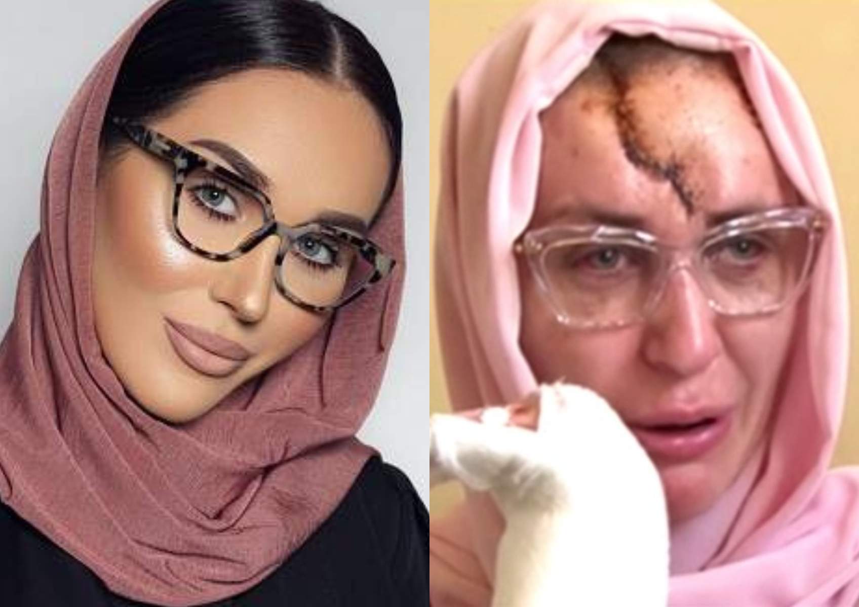 Dana Roba susține că soțul ei și-a premeditat fapta: "Nu aveam ciocanul ăla în casă..." Vedeta a ...